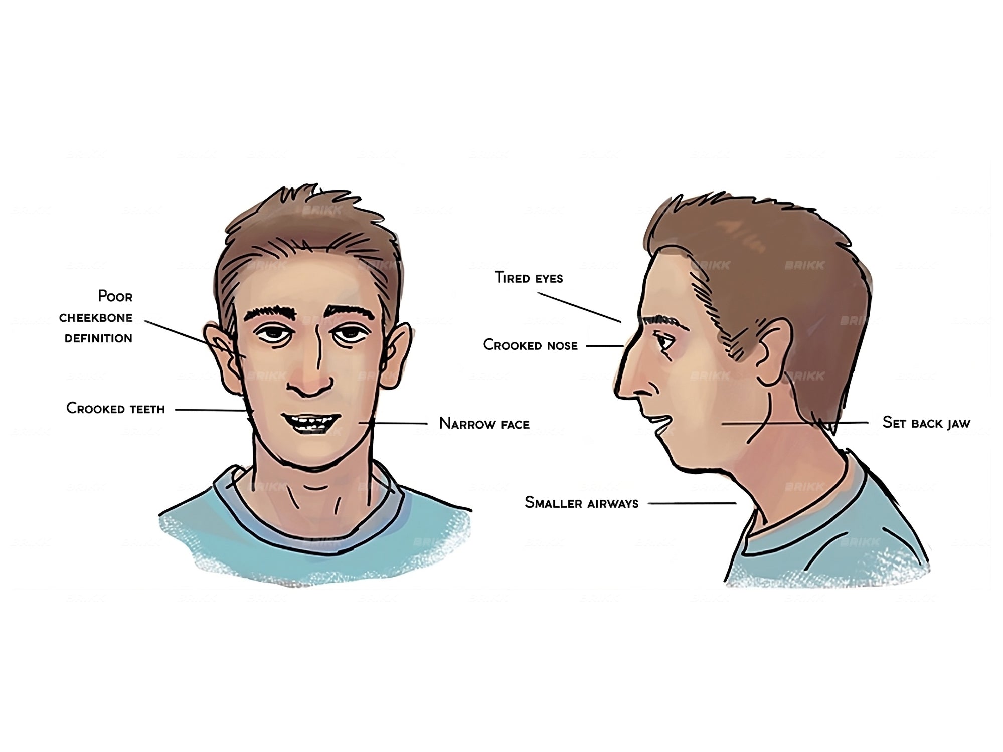 Train your jaw and facial muscles with BRIKK MastiGum® and JawMaxxer®